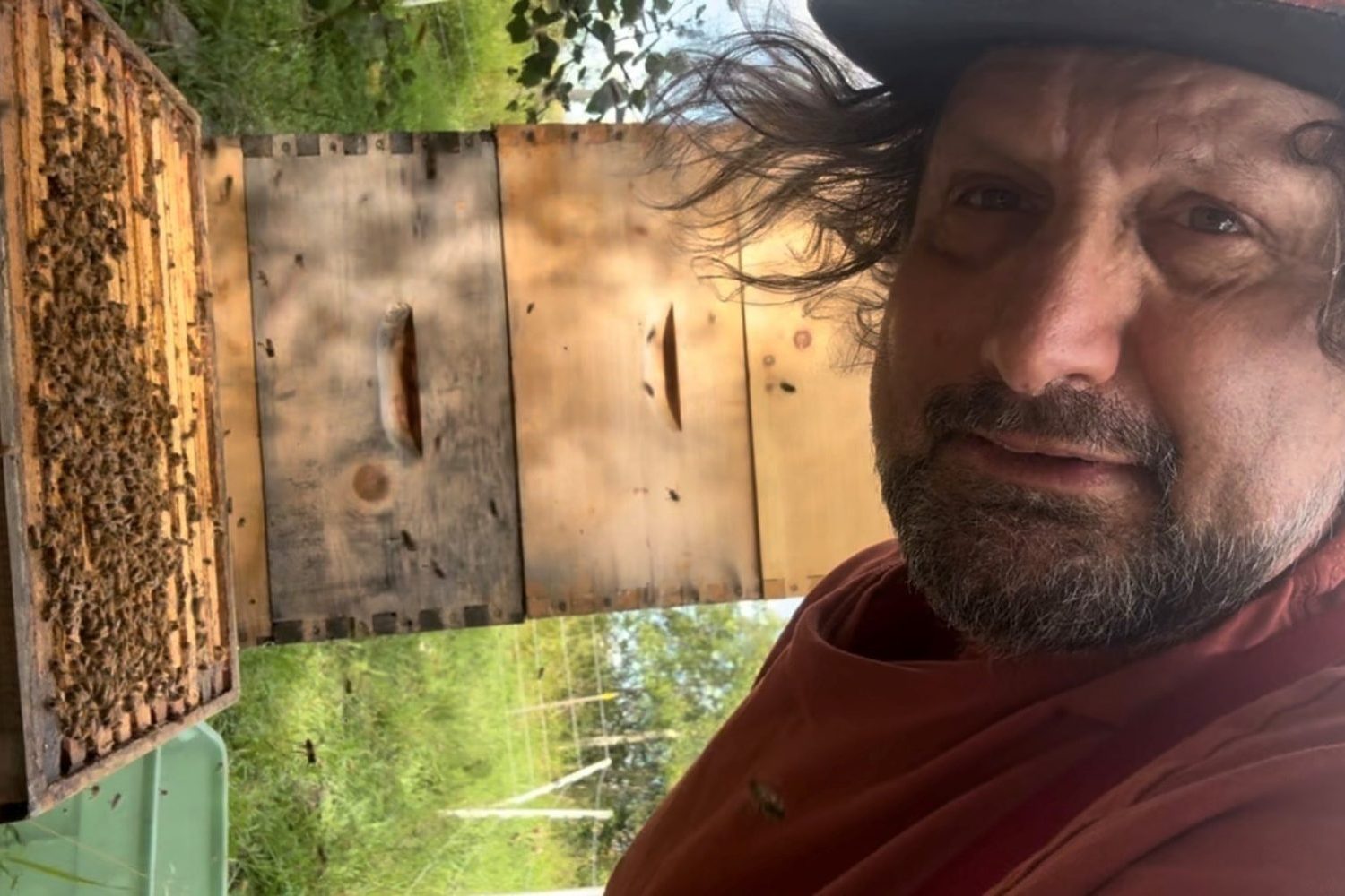 Acupuncture in Edmonton - The Acupuncture Turning Point